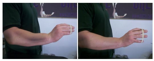 Rubber Band Finger Extensions - Exercises For Injuries